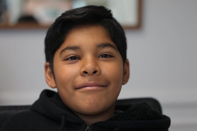 Lost Eye – Advanced Artificial Eyes – Custom Fit Prosthetic Eyes With ...